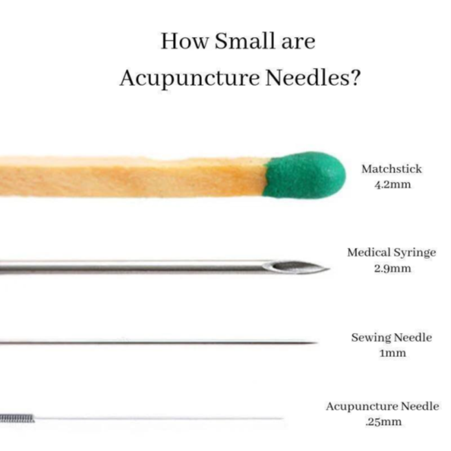 What Is Acupuncture, How It Works, and What It Helps With